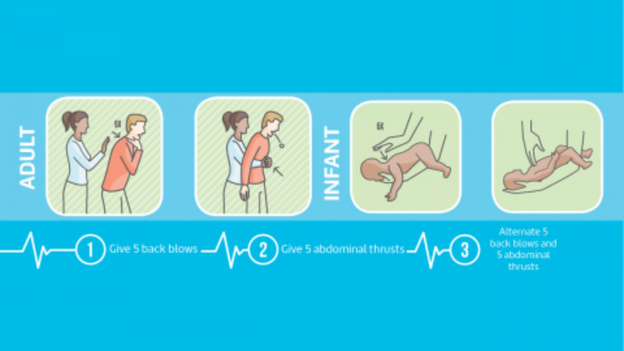 How To Perform The Heimlich Manoeuvre | Lenmed Group